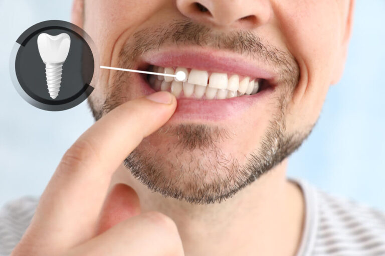 Vanity Cosmetic Surgery Hospital, Istanbul - Turkey Travel Planner